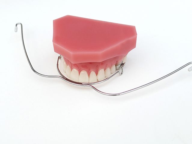 Behandelingen - Orthodontie Assen