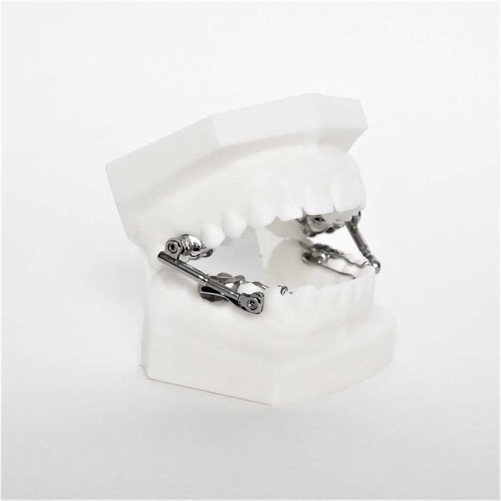 Behandelingen - Orthodontie Assen